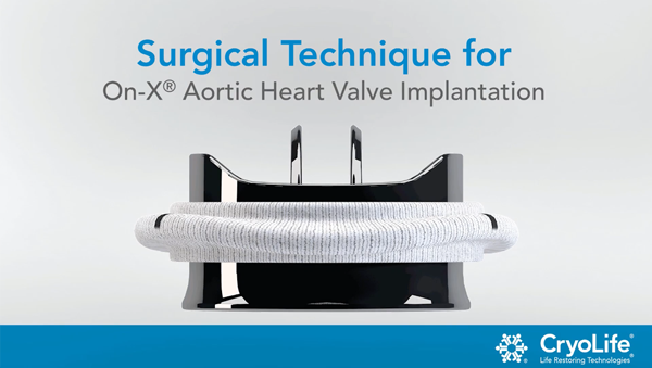 ELITE Resources - CryoLife, Inc.